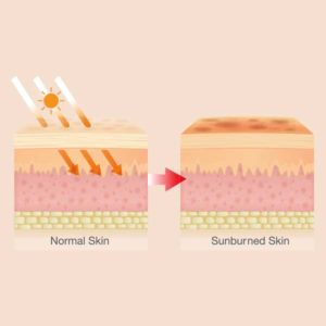 Which sunscreen lotion is the best for you? - Kama Ayurveda